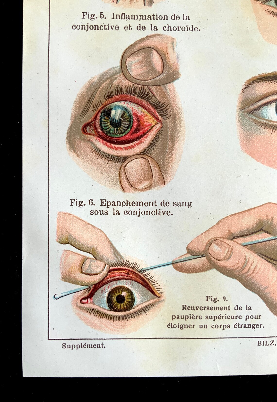 Antique BOSS-EYED Print French Anatomy Bookplate Circa 1900 | Etsy
