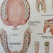 Antique Print 1920s German Anatomy FACE Dissection TOOTH DISEASE Teeth ...