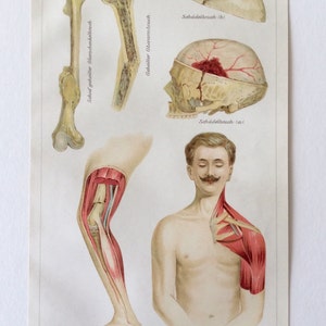 Antique Print 1907 German MUSCLE BONE FRACTURE Medical Chromolithograph ...