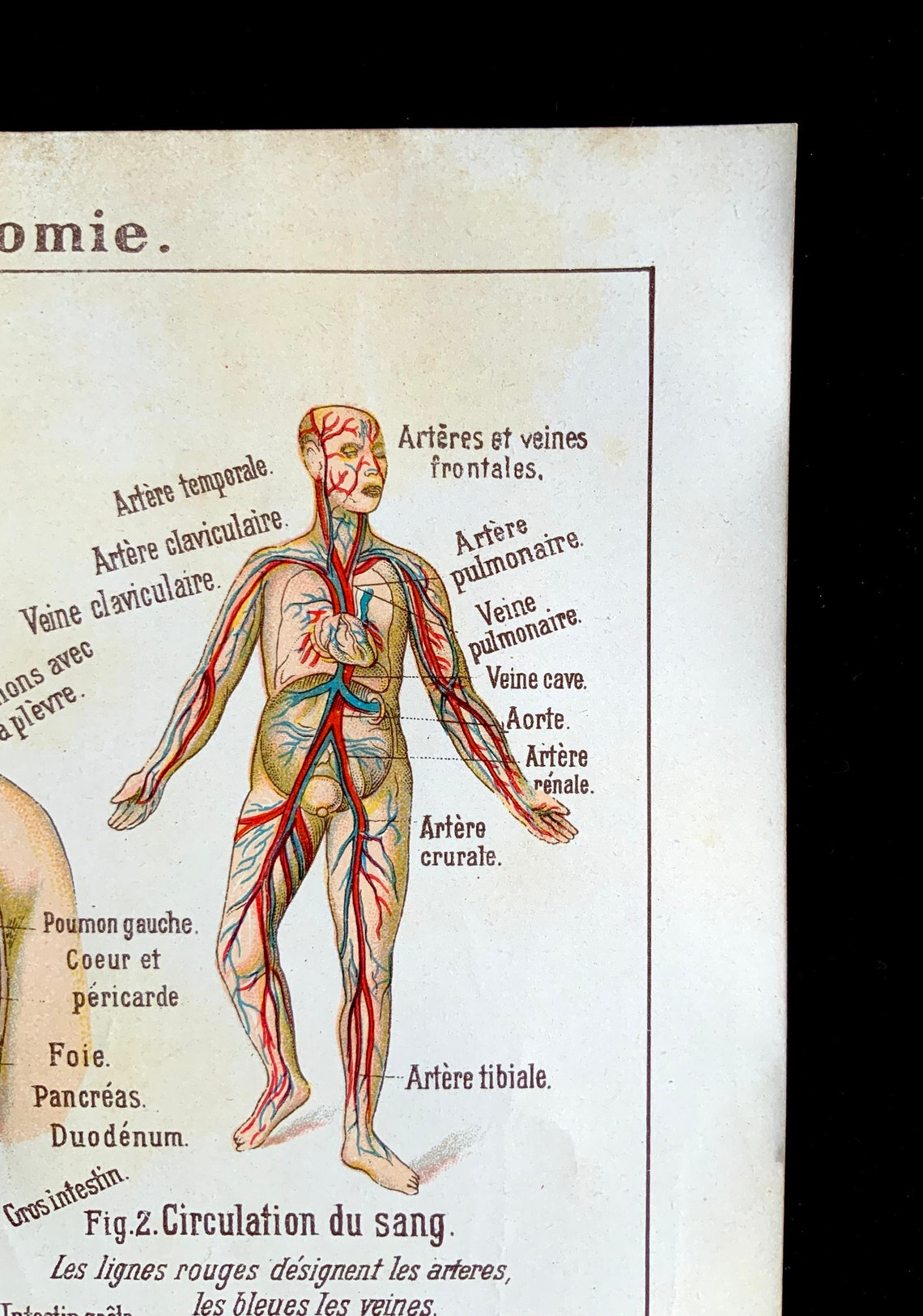 Antique Print French Dissection Anatomy 1900 Chromolithograph | Etsy