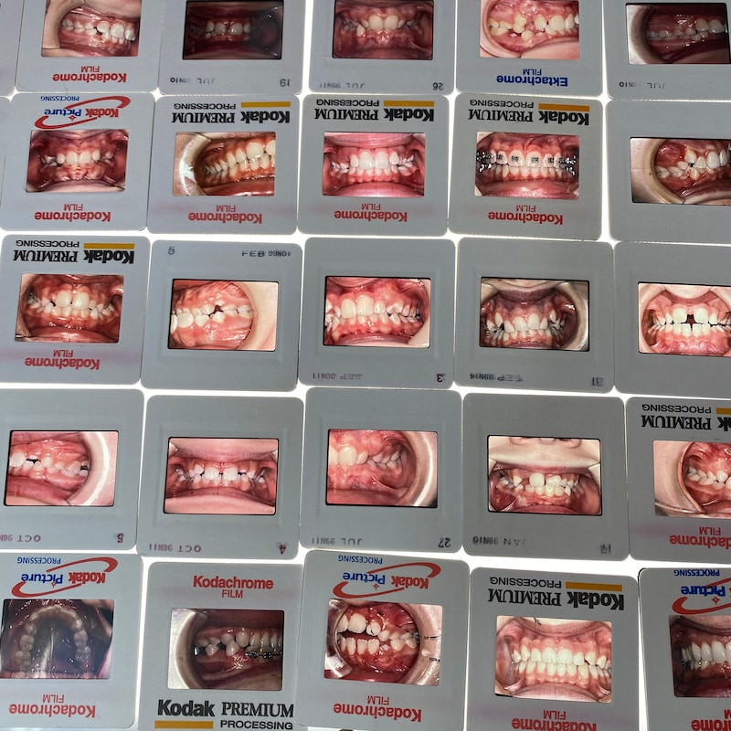 Vintage Dental Oddity - Etsy