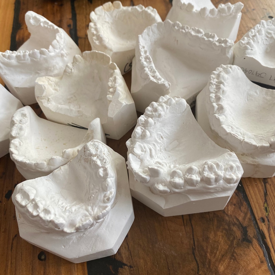 Creepy Vintage Dental Teeth Mold Upper or Lower Old Dentist Tooth Mold ...