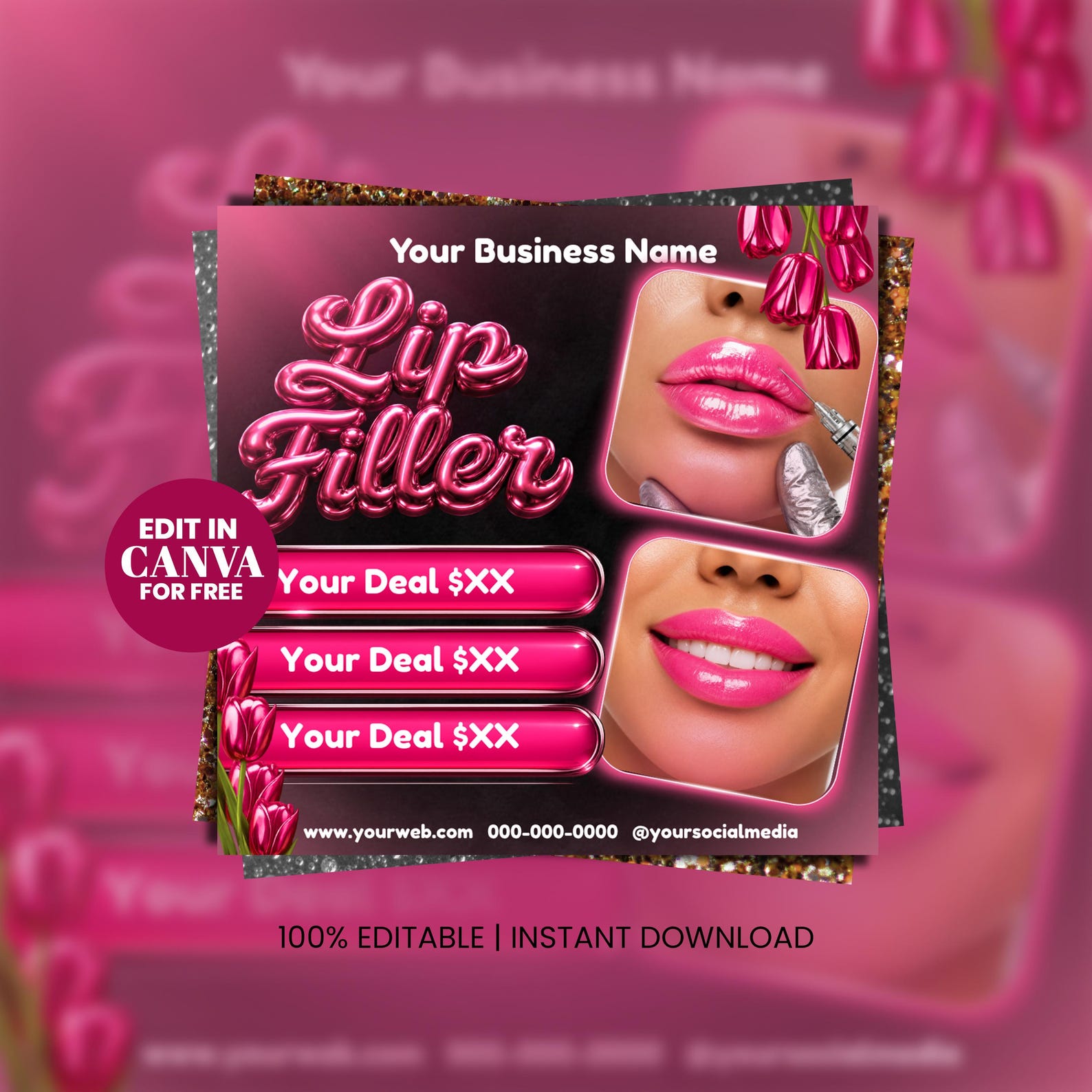 Lip Filler Flyer Template, Editable Med Spa Promotion (digital Download ...
