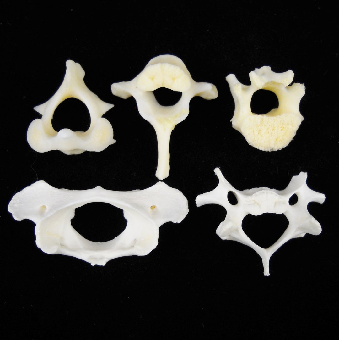 Multipack 1-2" Raccoon Vertebrae Real Spinal Bone Vertebra Taxidermy ...