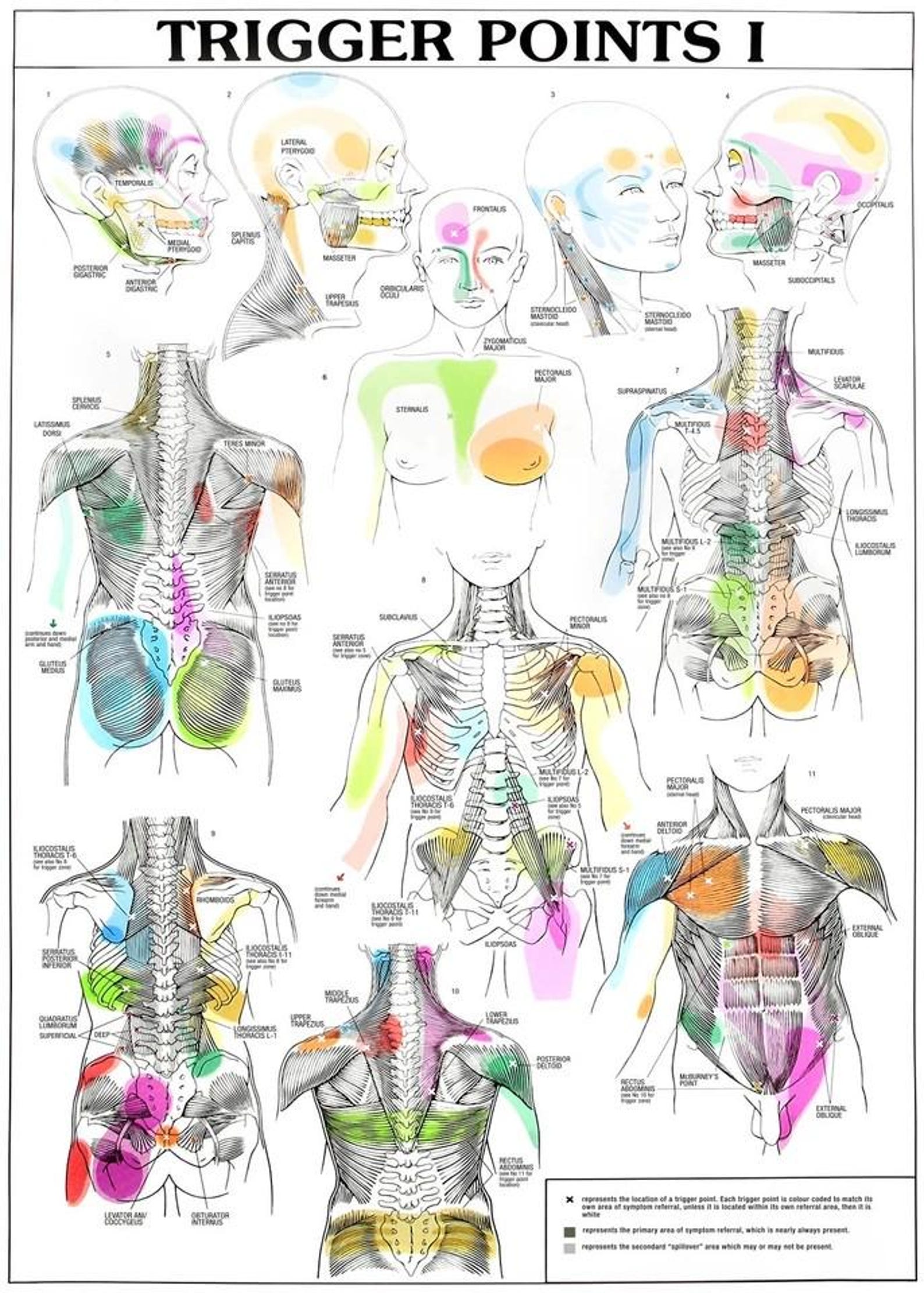 TRIGGER POINTS Part 1 Anatomical Diagram Chart Anatomy Print Premium ...