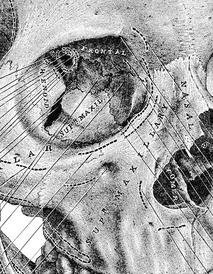 Printable Skull Vintage Human Anatomy Medical Clip Art - Etsy