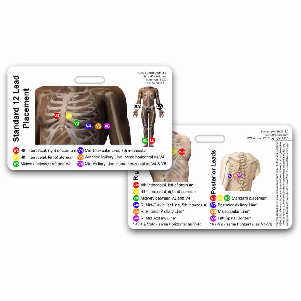 Pediatric Ecg Electrode Placement