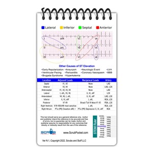 Reusable, EKG, Nurse Notepad, Nursing Notes, Gift for Nurse, Paramedic ...
