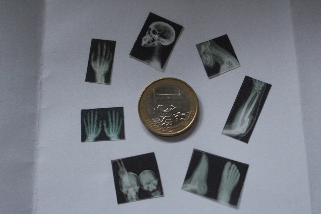 Set Van 7 X-ray / Röntgen Foto's Van Mensen, Poppenhuis Miniaturen ...