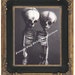 Victorian Siamese Twins Skeleton Art Print 8 X 10 - Anatomical Medical ...