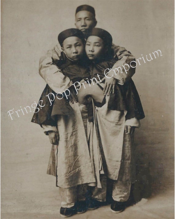 Home Décor Korean Siamese Twins Victorian Sideshow Circus Freak Art ...