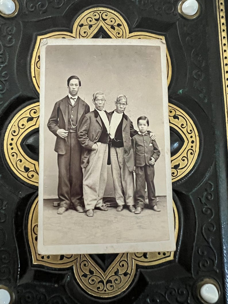 Siamese Twins Chang & Eng CDV Carte De Visite Photo - Etsy