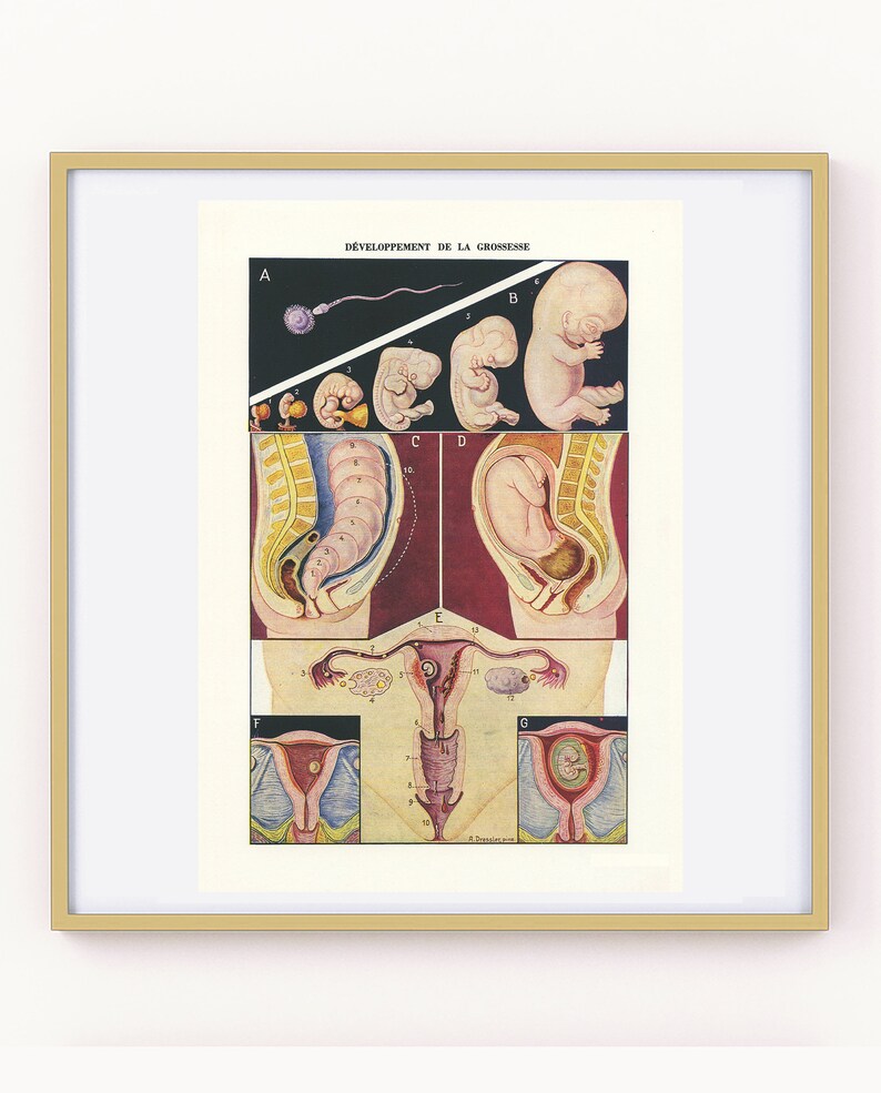 30x40 Cm Large Pregnancy Poster for Medical Doctors Gift. | Etsy