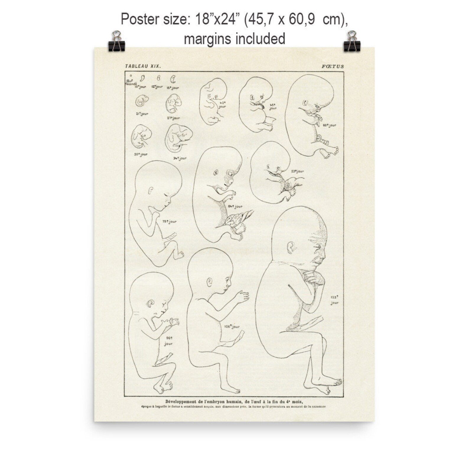 Large anatomy poster foetus reprint from 1952. French Vintage | Etsy