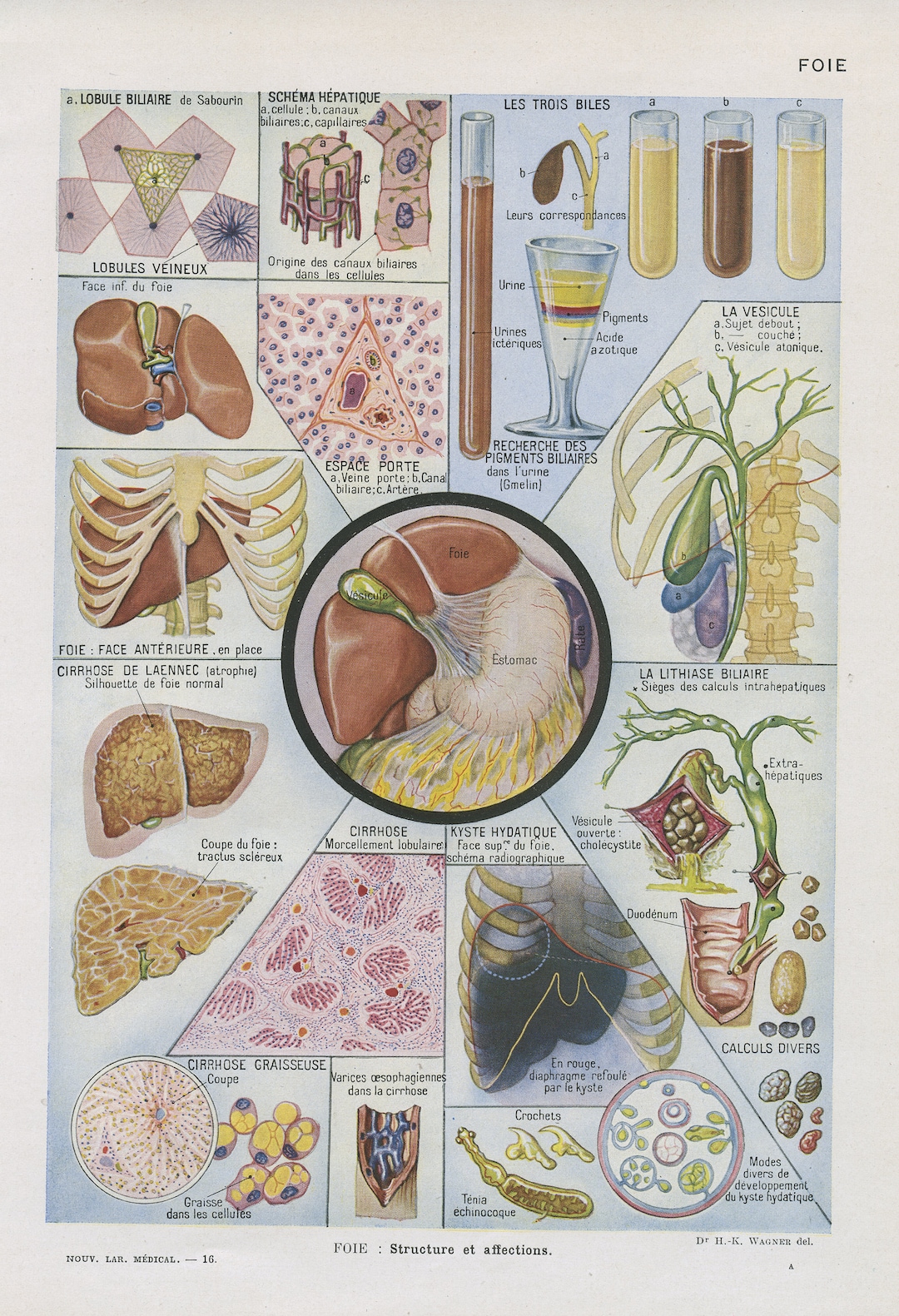 1962 French Vintage Liver Medical Print. Small Antique Anatomy Print ...