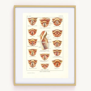Small Larynx Poster 1912 French Vintage Anatomy Print Vintage Medical ...