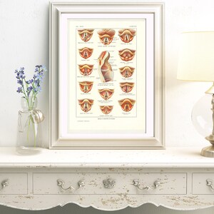 Small Larynx Poster 1912 French Vintage Anatomy Print Vintage Medical ...