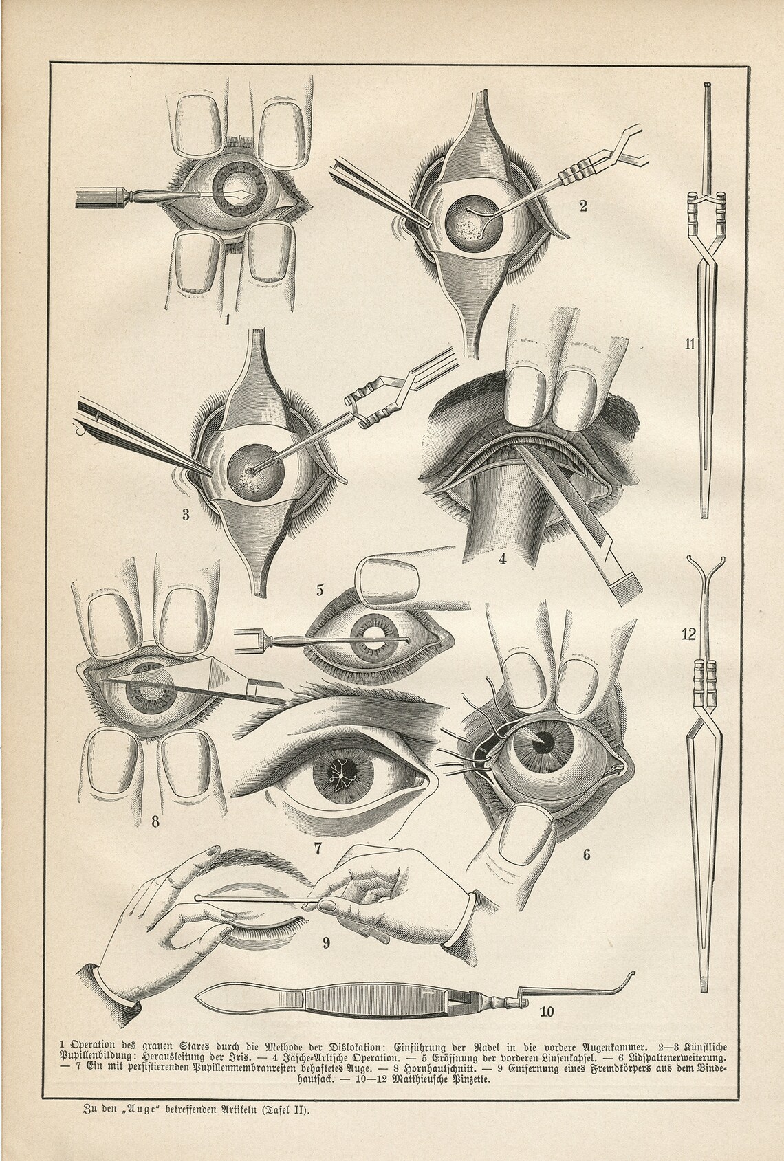 1890 Antique Eye Engraving for Black and White Anatomy Wall Decor ...