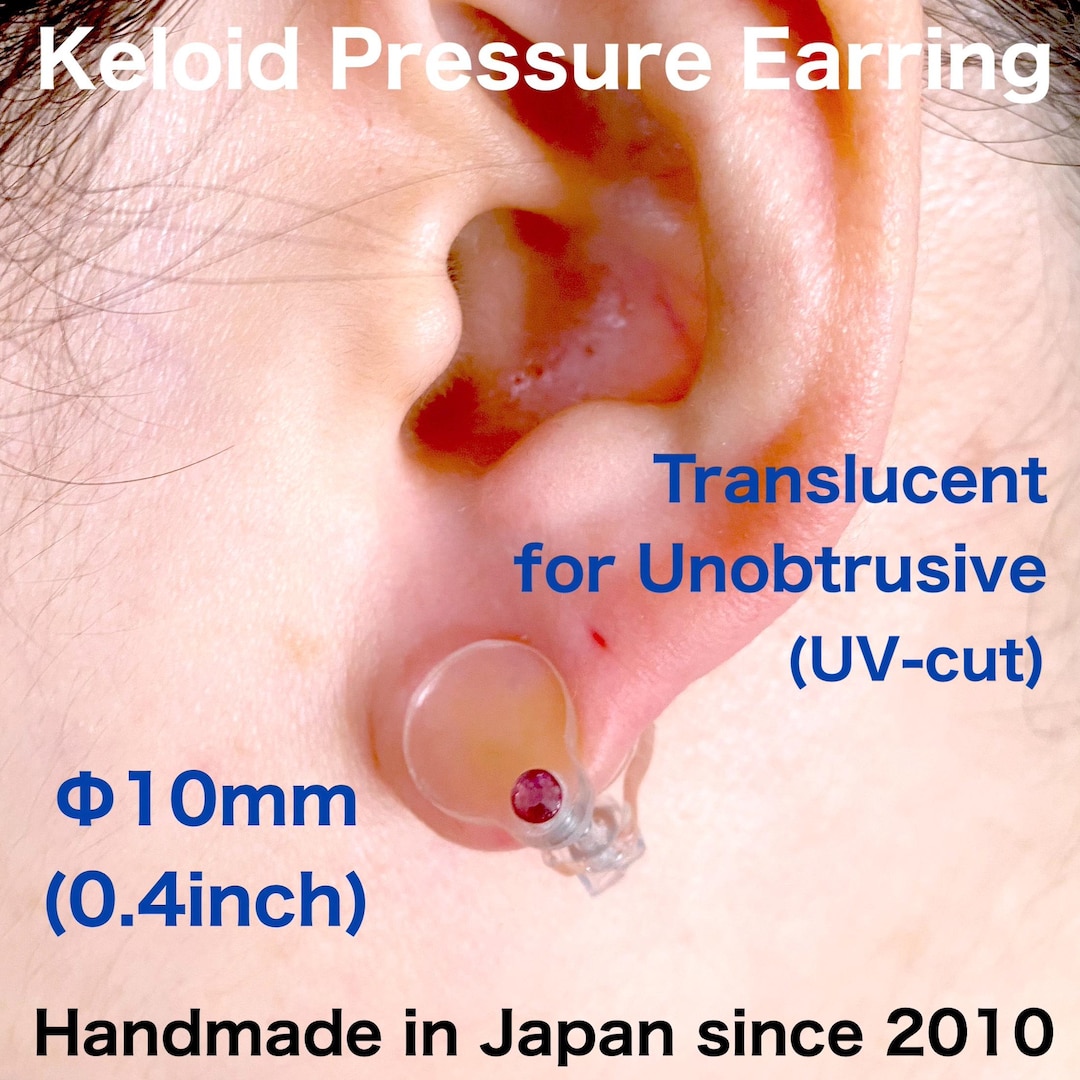 10mm Keloid Compression Earring: Stainless Steel, Silicone-lined - Etsy