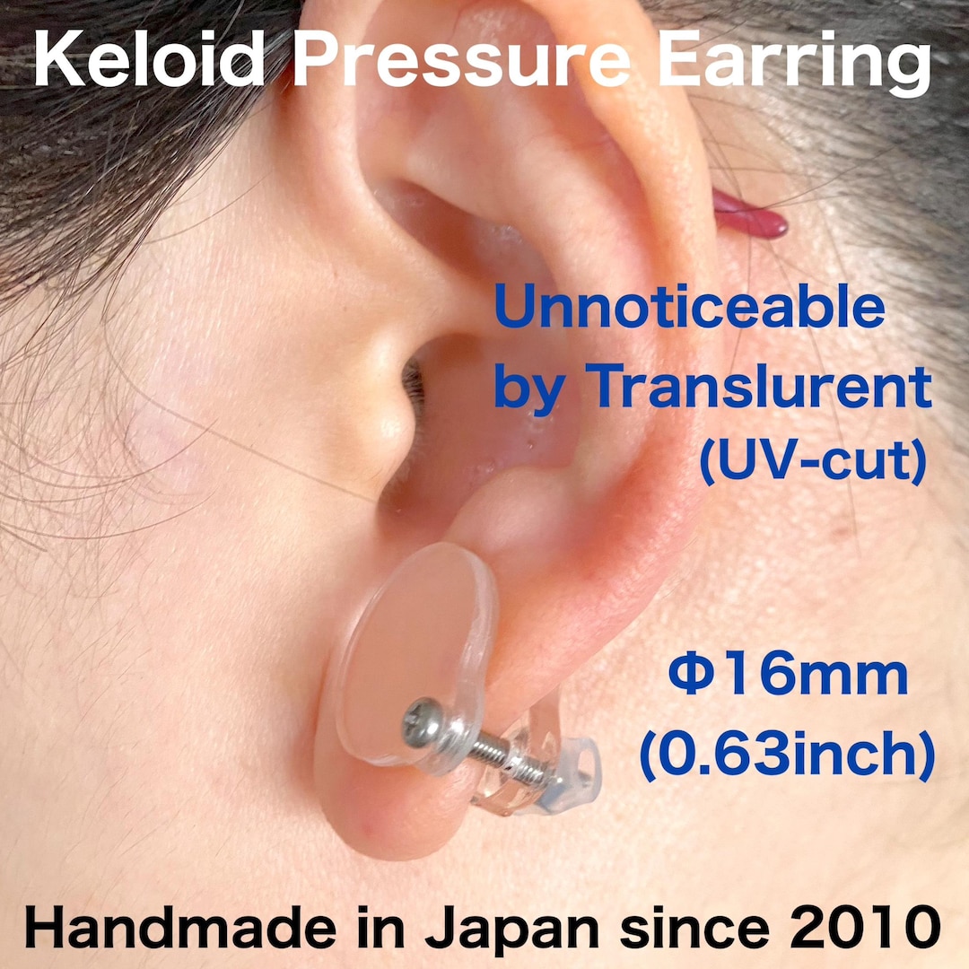 16mm Stainless Steel Keloid Compression Earring: Pressure Scar ...