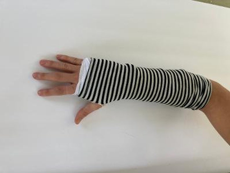 Arm Cast Cover - Stripe and Solids - Etsy