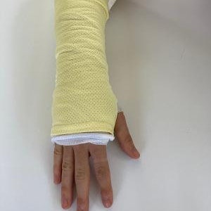 Arm Cast Cover - Stripe and Solids - Etsy
