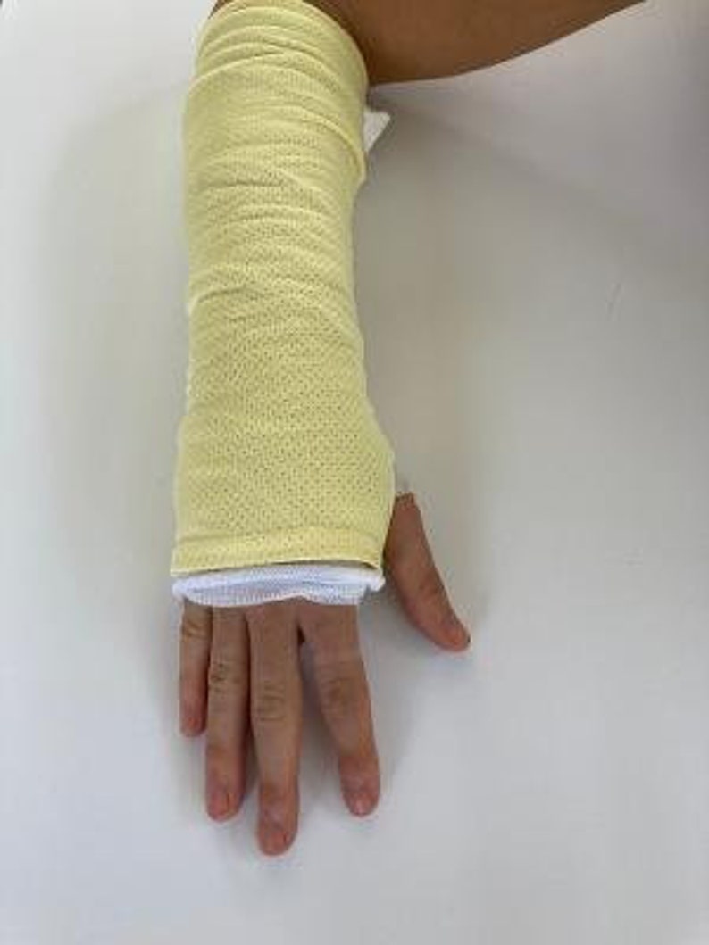 Arm Cast Cover - Stripe and Solids - Etsy