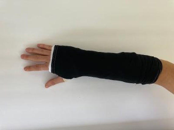Green Arm Cast
