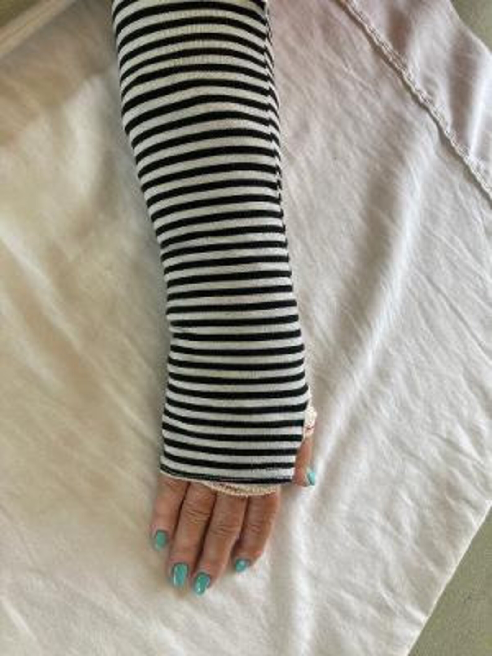 Arm Cast Cover - Stripe and Solids - Etsy