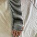 Arm Cast Cover - Stripe and Solids - Etsy