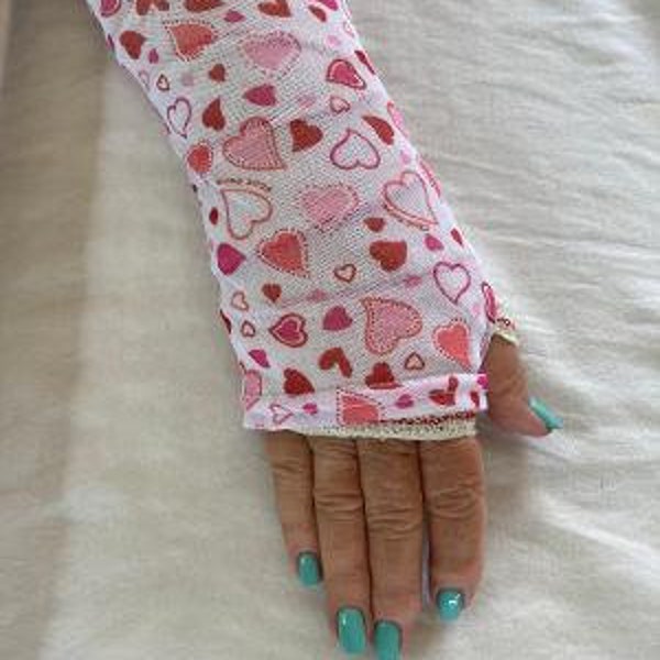 Arm Cast Cover - Etsy
