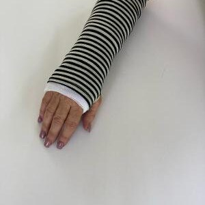 Arm Cast Cover - Stripe and Solids - Etsy