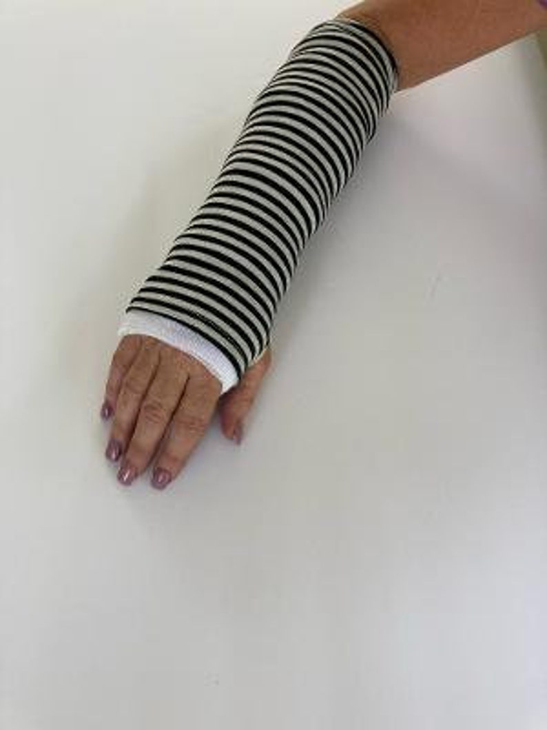 Arm Cast Cover - Stripe and Solids - Etsy