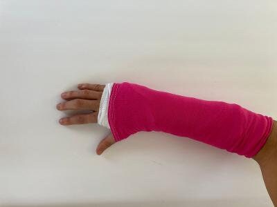 Broken Wrist Cast Pink