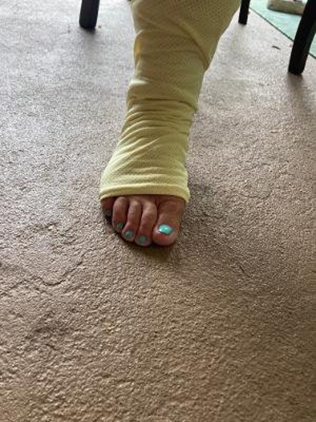 Leg Cast Cover Solid Options Yellow - Etsy