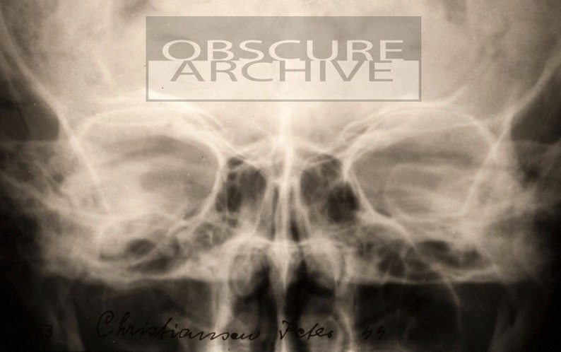 SKULL XRAY Beautifully Haunting Photographic Print Made From - Etsy