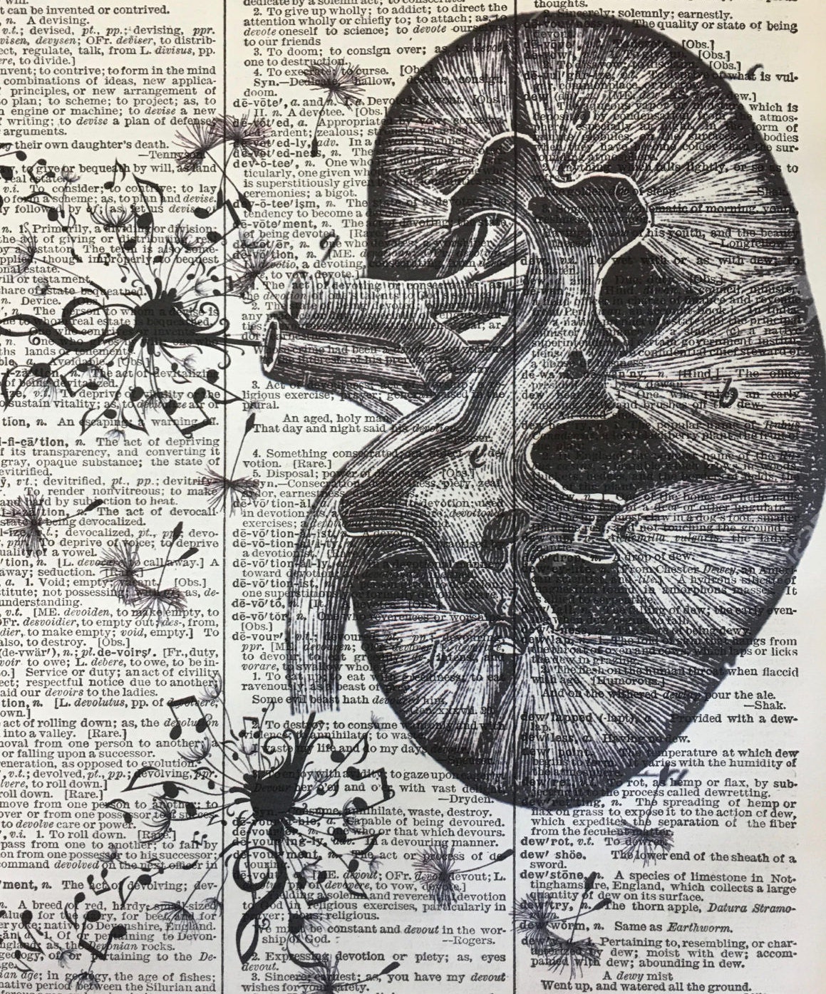 Anatomical Print Kidney Art Print Medical Art Kidney | Etsy