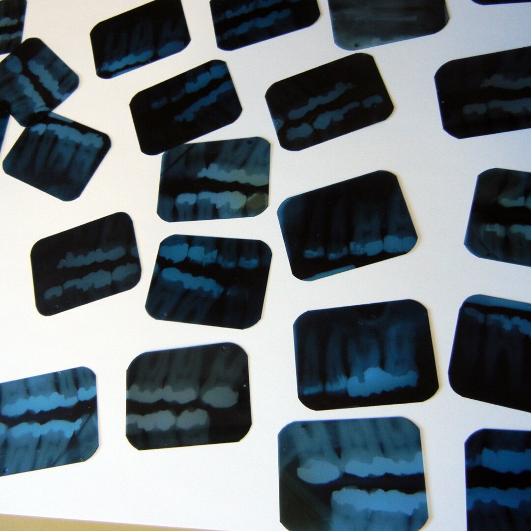 Lot of 30 Xrays Tooth Film Dental X-rays Tooth Xrays Bone Mix of Two ...