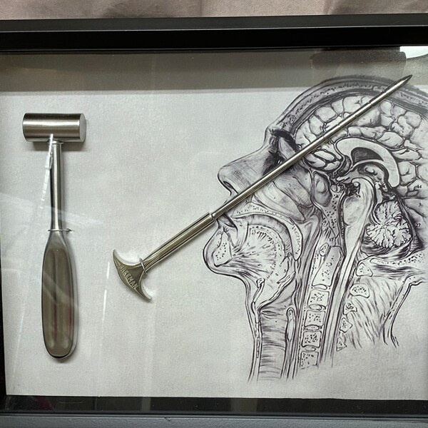 Lobotomy Tools in Shadow Box - Etsy