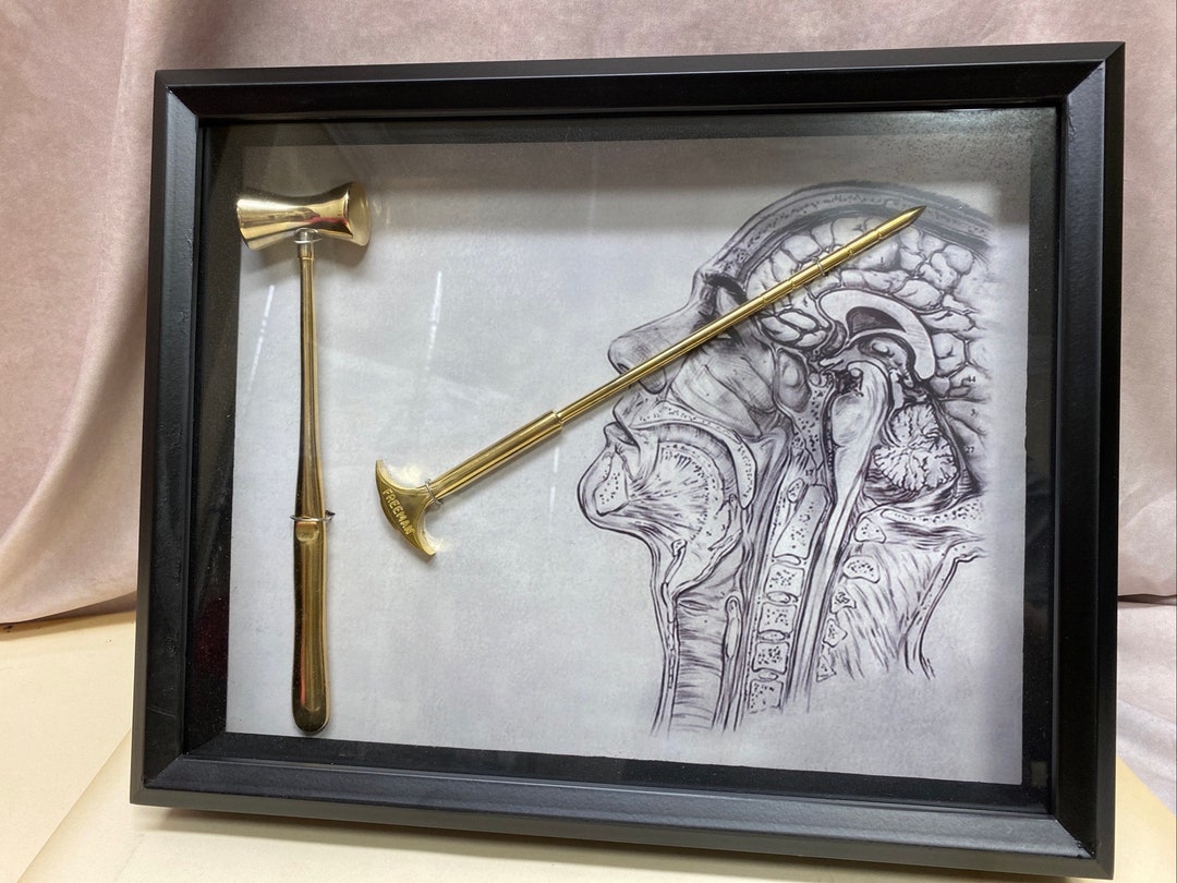 Lobotomy Orbitoclast & Hammer Surgical Medical Tools Shadowbox - Etsy