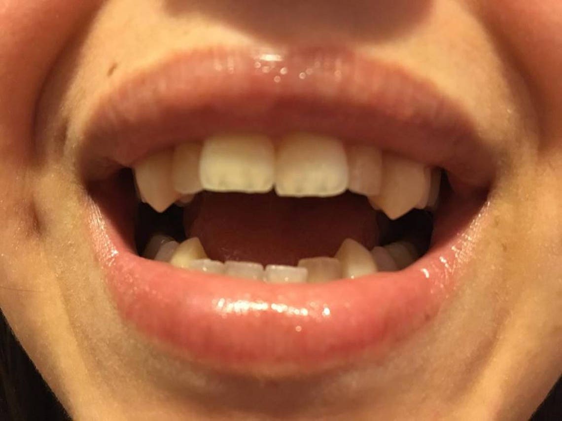 Cat Fangs please Read Item Description - Etsy