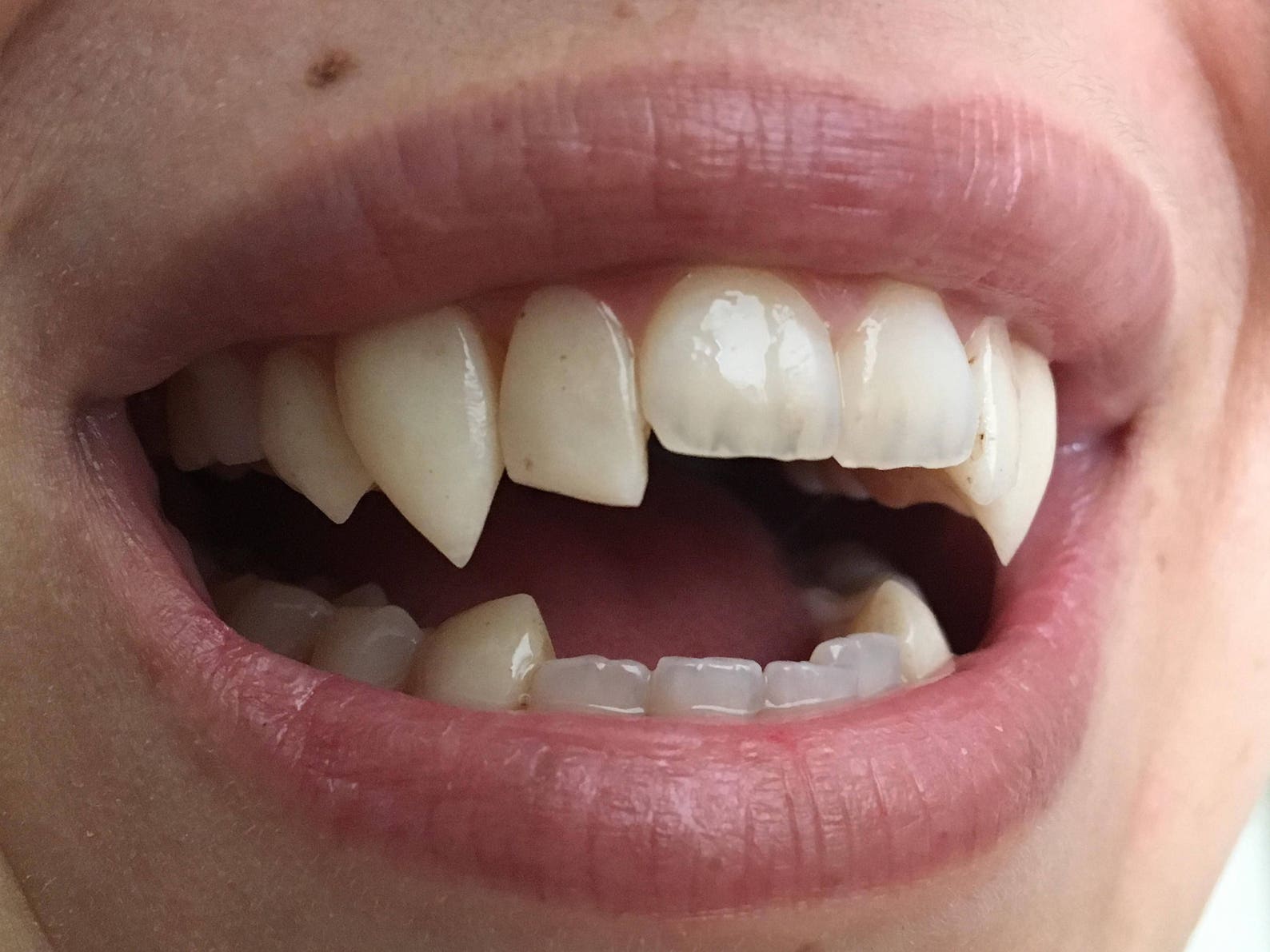 Hybrid Fangs please Read Item Description - Etsy