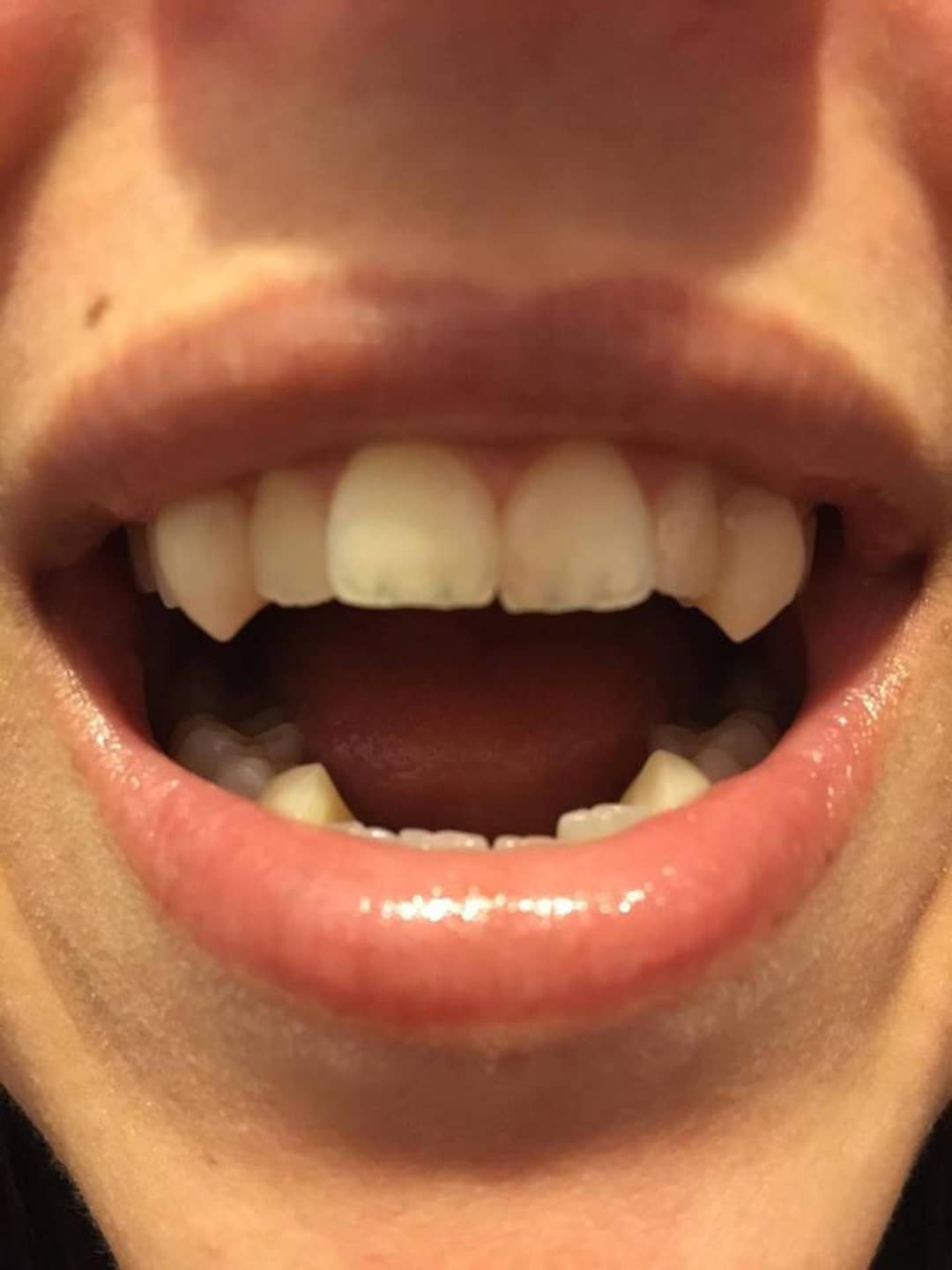 Cat Fangs (please Read Item Description!) - Etsy