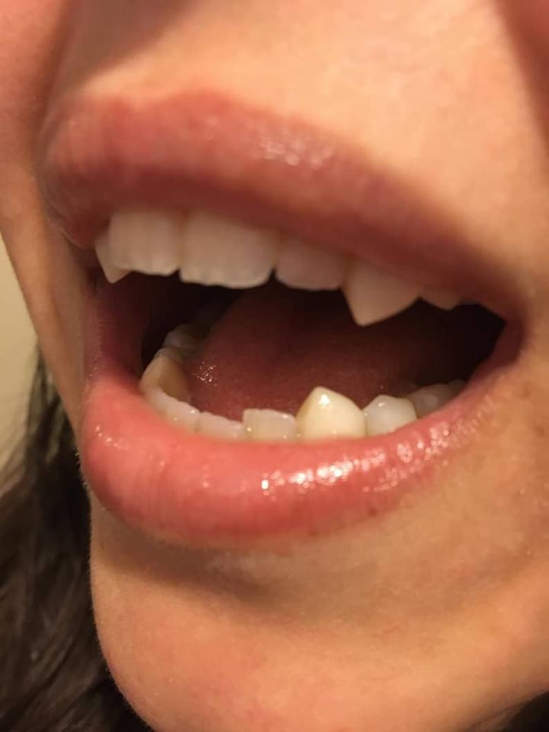 Cat Fangs please Read Item Description - Etsy