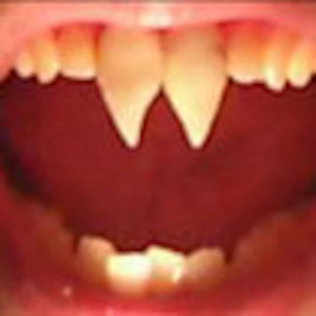 Nosferatu Vampire Teeth