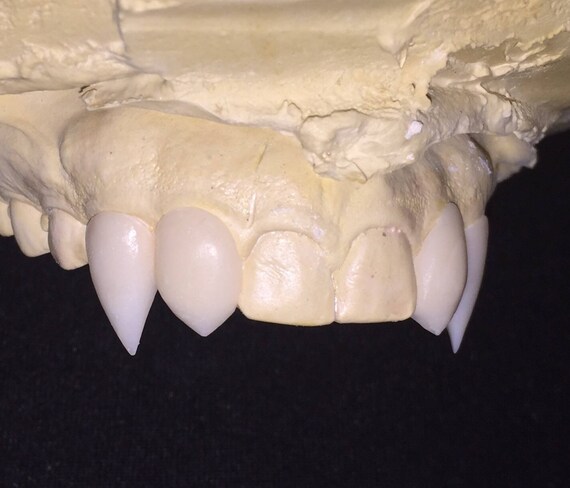Double Row Of Teeth