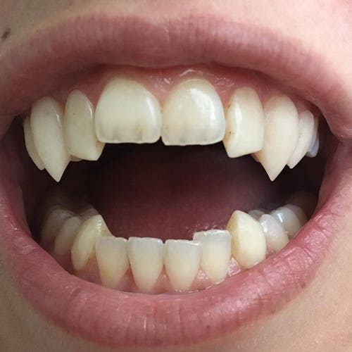 Traditional Fangs please Read Item Description - Etsy