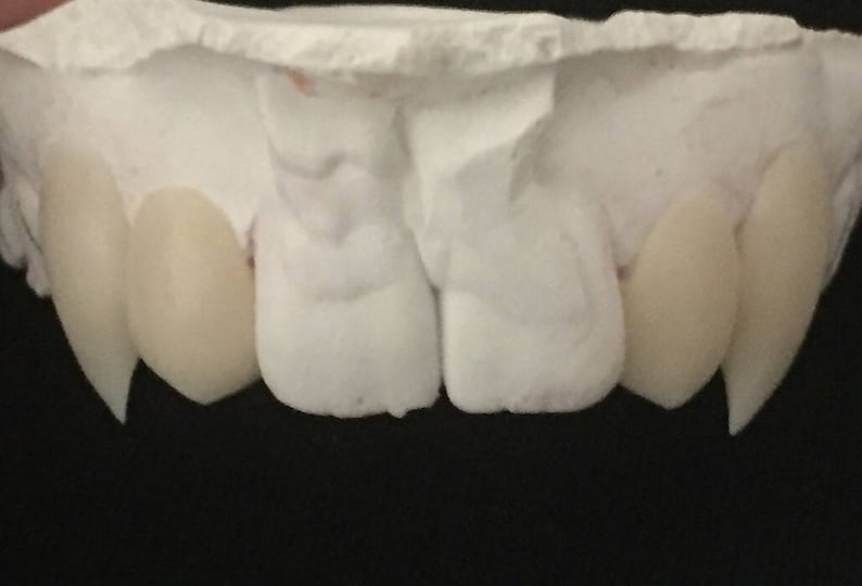 Double Set Fangs please Read Item Description - Etsy