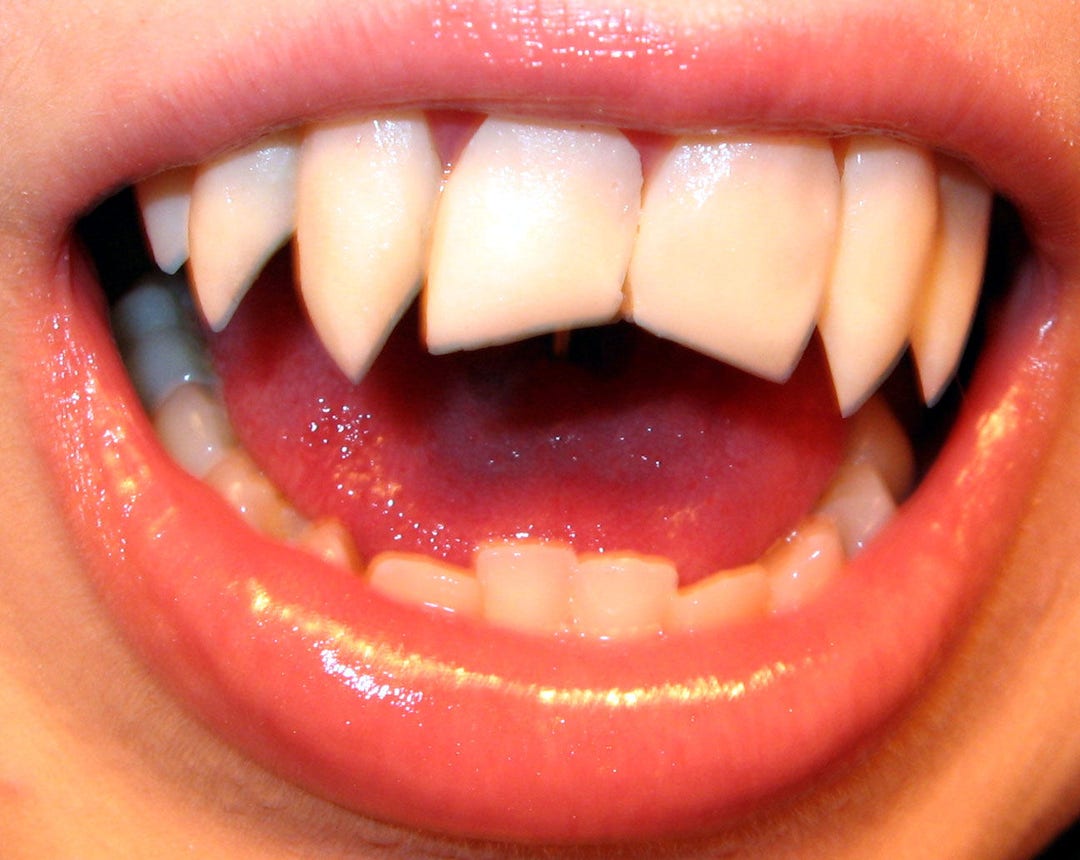 Ginger Snaps Replica Fangs (please Read Item Description!) - Etsy