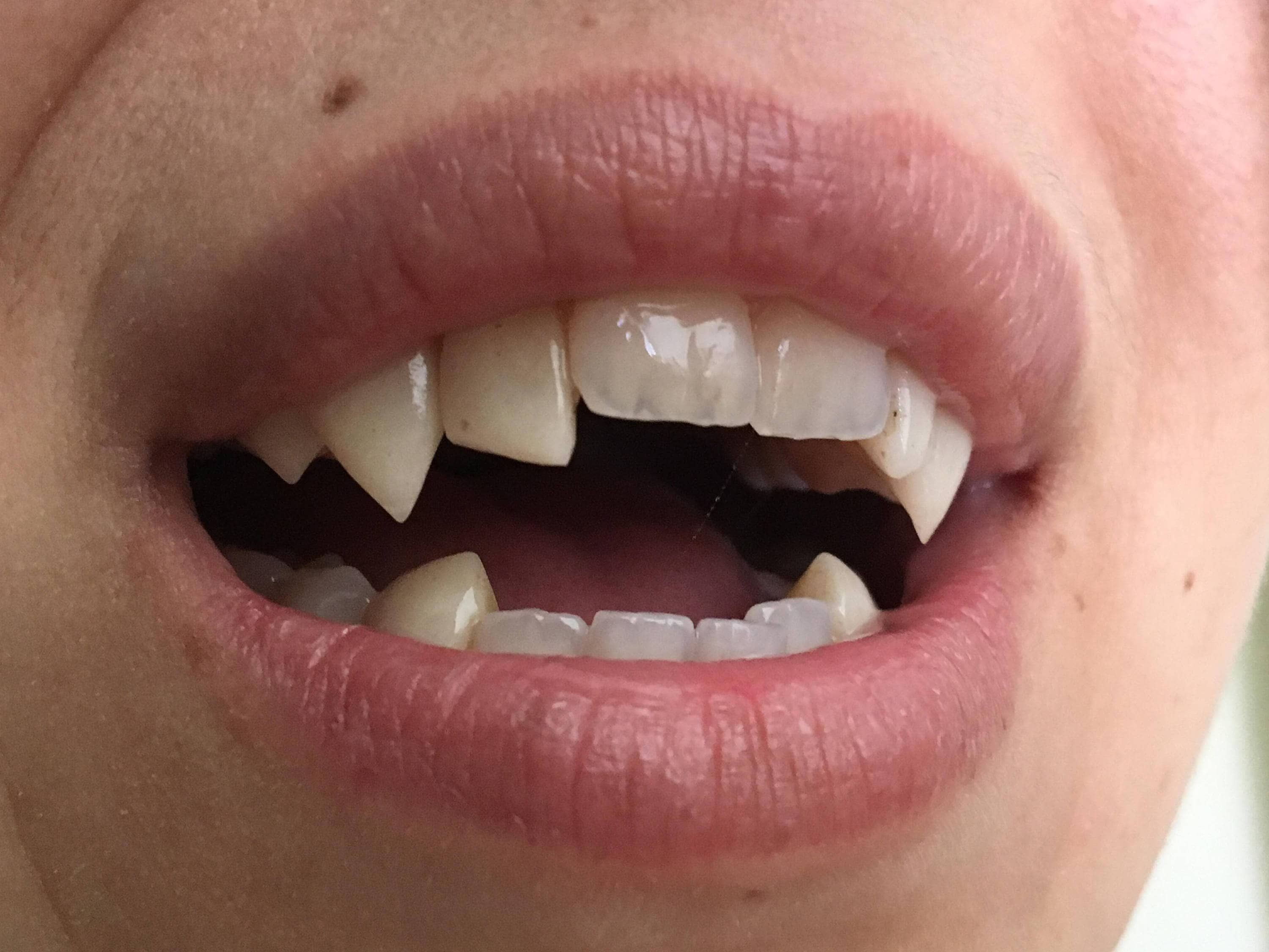 Hybrid Fangs Custom made from scratch | Etsy